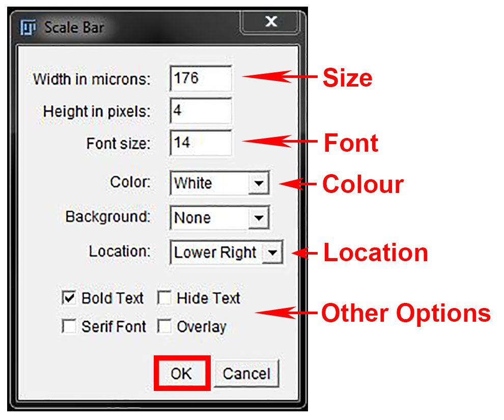 Fiji Imagej Scale Bar Imagej Set Scale Yaekoricyc